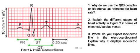 Solved R Why Do We Use The QRS Complex Or RR Interval As Chegg Com