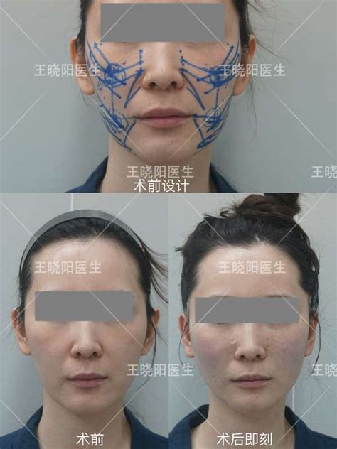 整形外科王晓阳医生 的想法 求美者30 知乎