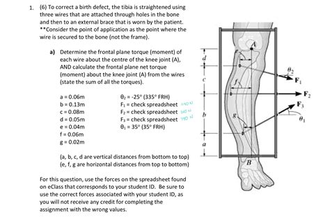 Solved 6 To Correct A Birth Defect The Tibia Is Chegg Com