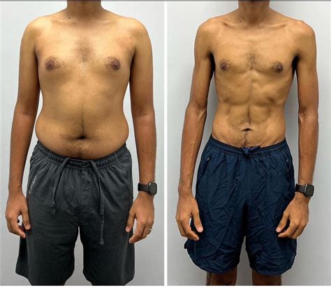 Skinny Fat To Toned How Jayant Lost 17kg Lifelong Training