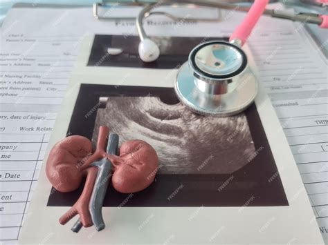 Ultrasonido Renal Y El Médico Analiza La Condición Renal Del Paciente