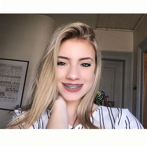 Pin By Bill Rowe On Cute Braces Cute Braces Cute Braces