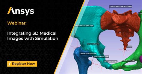 Integrating 3d Medical Images With Simulation Ansys