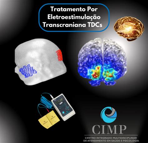Como Funciona O Tratamento Por Estimulação Transcraniana