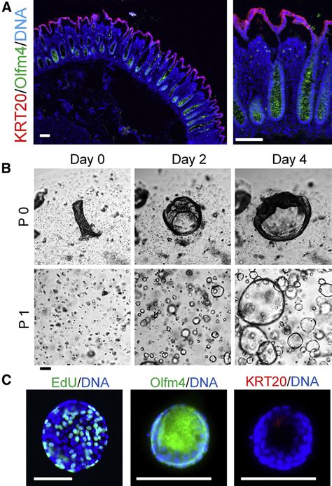 Organoid Culture Of Human Colonic Epithelial Cells A Download Scientific Diagram
