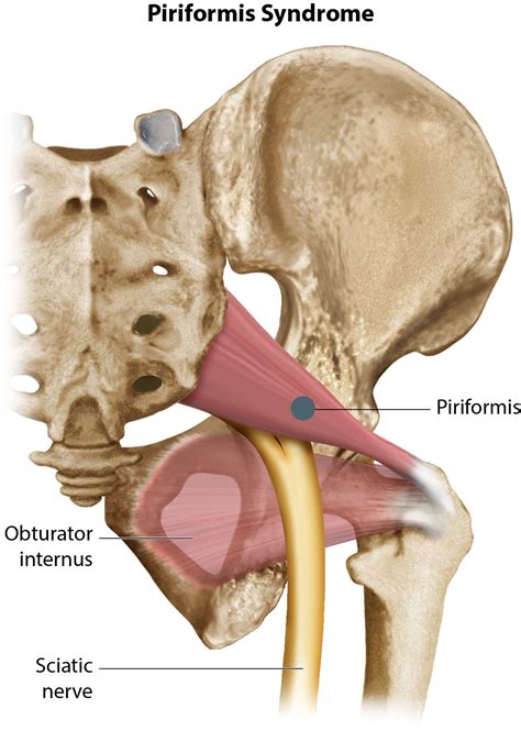 Take Test Piriformis Syndrome Piriformis Lab Values