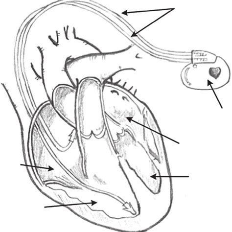 2 the cardiac pacemaker system download scientific diagram