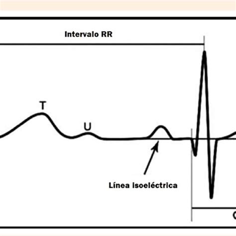 Correcta Medición Del Intervalo Qt Download Scientific Diagram