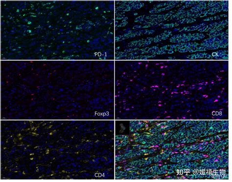 Treg 免疫抑制t细胞研究进展 知乎