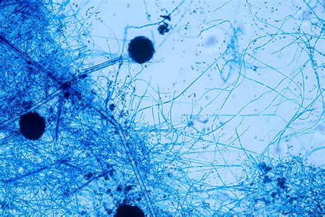 Aspergillus Under Microscope