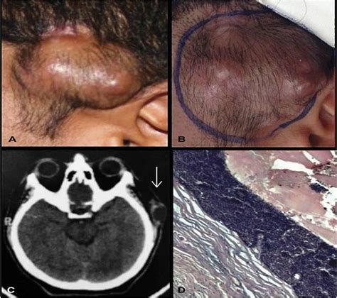 The American Journal Of Dermatopathology