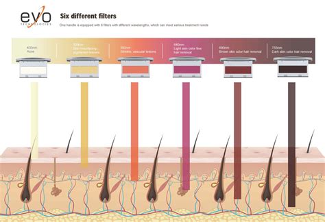 Evo Ipl Shr Evo Technologies