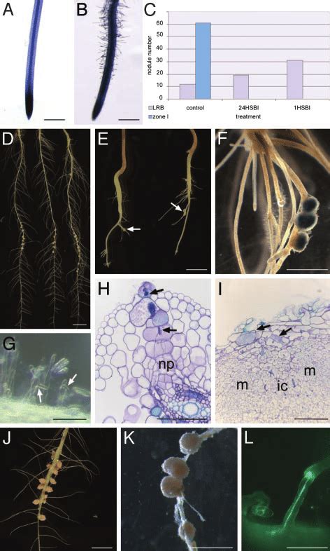 Comparison Of Root Morphology And Nodulation Traits Between