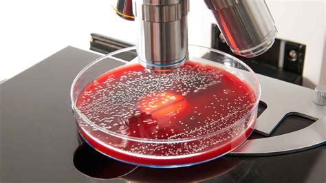 Health Even Bacteria Fighter Next Science Is Feeling The Coronavirus