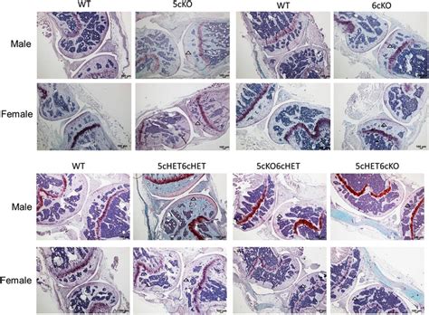 Adult Mice Carrying Col2 Cre Mediated Deletions Of Lrp5 Andor Lrp6