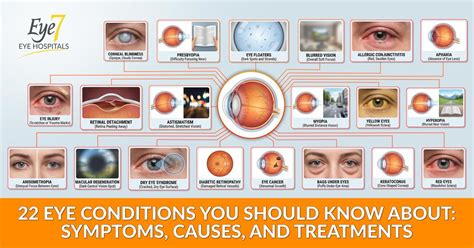 22 Eye Diseases Symptoms Causes Treatments And Cost