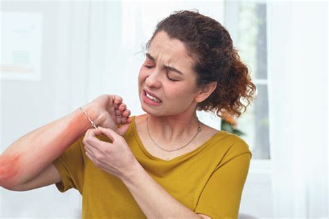 Follicular Eczema Symptoms Treatment And Prevention