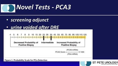 Updates In The Evaluation And Management Of Localized Prostate Cancer Ppt Download