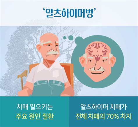 치매 중 환자 가장 많은 ‘알츠하이머 치매