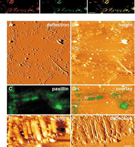 Figure 2 From Analyzing Focal Adhesion Structure By Atomic Force