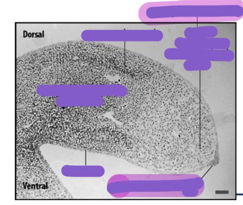 Limb Bud Outgrowth Diagram Quizlet
