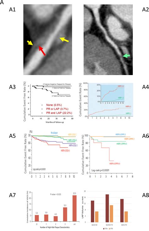 SCCT Expert Consensus Document On Coronary Computed Tomographic Angiography A Report Of