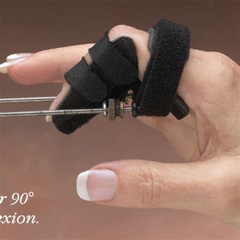 Static Progressive Pip Finger Extension Splint North Coast Medical
