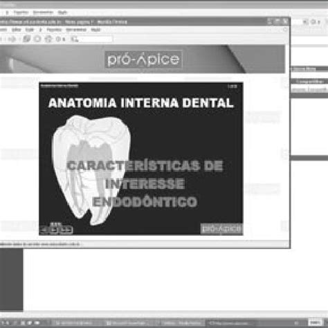 A Panoramic Radiograph Of A Patient With Dentinogenesis Imperfecta Who