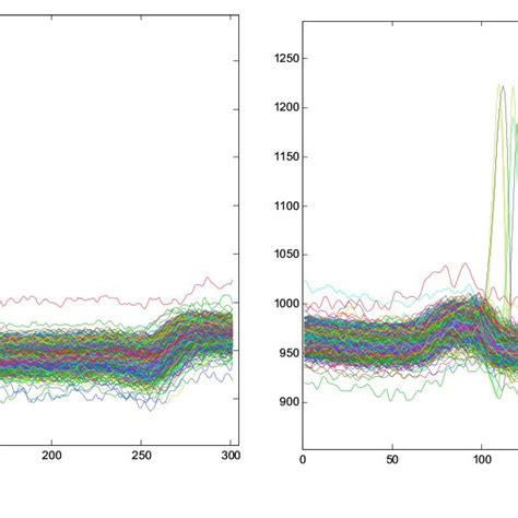 Examples Of Cardiac Patterns Obtained By Centered Or Non Centered