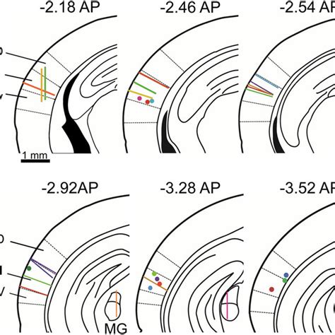 Location Of Recording Sites In The Auditory Cortex Locations Of