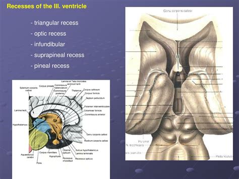 Ppt Diencephalon Iii Ventricle Dr Gallatz Katalin Powerpoint