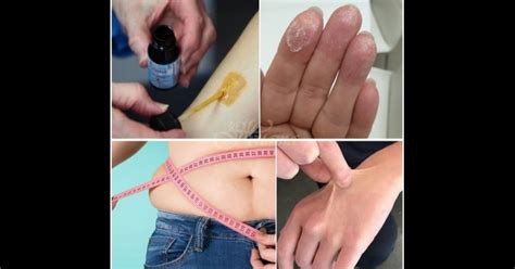 8 домашни теста за проверка на здравето откриват дефицит на йод селен метаболитни нарушения