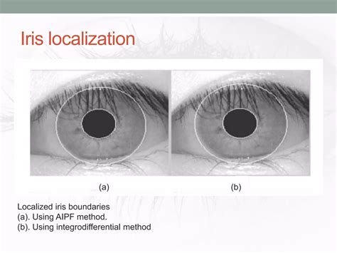 Iris Recognition System Pdf Eye And Vision Conditions Diseases