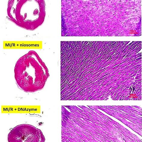Effects Of Nano Niosomes Containing Dnazyme On Myocardial Morphology Download Scientific