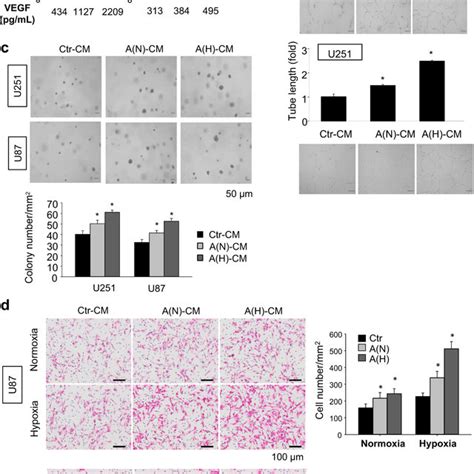 Astrocytes Potentiate The Hif 1 Signaling Pathway In Glioblastoma Download Scientific Diagram