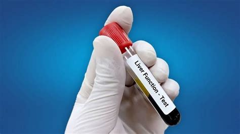 LIVER FUNCTION TESTS EXPLAINED IN SIMPLE TERMS MY Babe EXAMS