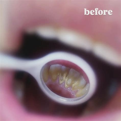 Drranya Sameer🦷 Drranya22 • Instagram Photos And Videos