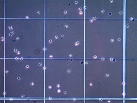 python counting yeast cells from a hemocytometer imag