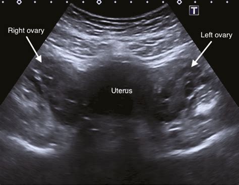 Sex Ed Is A Joke Here In The Us R Trollxchromosomes