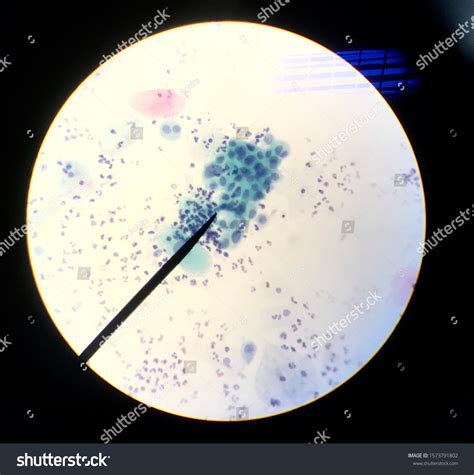 Squamous Cells Reproductive Female Cytology Concept Stock Photo 1573791802 Shutterstock