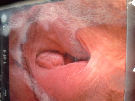 Tribute Pics Xnxx Adult Forum