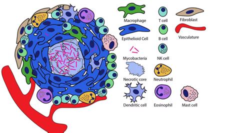 Nursing Care For Tuberculosispptx