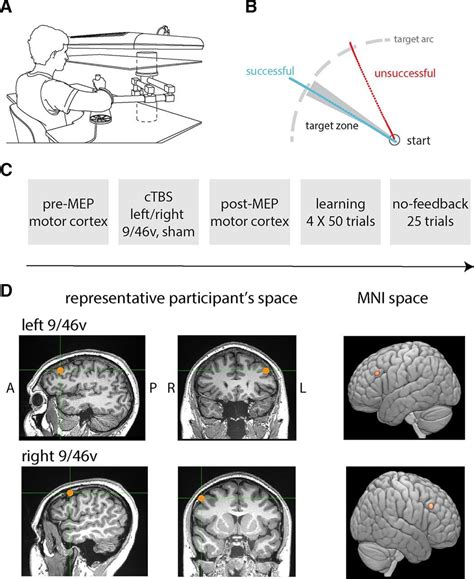 Ventrolateral Prefrontal Cortex Contributes To Human Motor Learning R