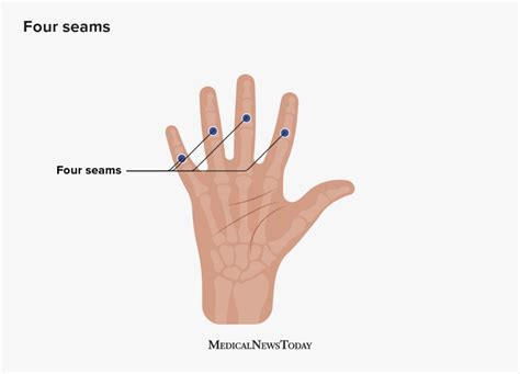 Chinese Acupuncture Points