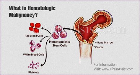 Hematologic Malignancies Classification Prevalence Symptoms