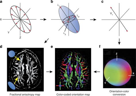 Diffusion Tensor Imaging A For Each Voxel The Diffusion Of Water Is