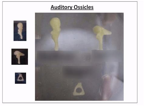 Ear Ossicles Diagram Quizlet