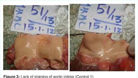 Figure 2 From Aortic Intimal Staining In Fresh Water Drowning A Case