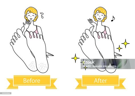 피부 관리 건조 피부 문제 전후 귀여운 여성 일러스트 일러스트 간단한 벡터 스킨 케어 건조 전후 발 피부 문제 예쁜 여자의 클립 아트 간단한 그림 벡터 Reverse
