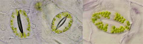 Guard Cell Microscope